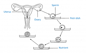 15.9.1 Gamete Formation (Structured Question 1 & 2) - SPM Biology